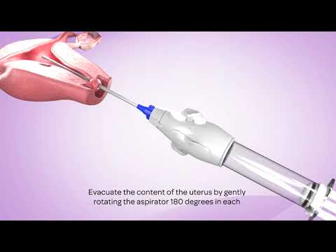 MVA procedure
