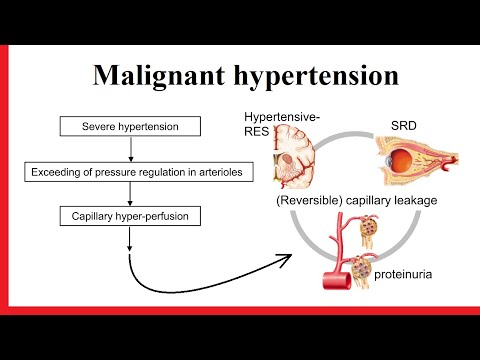 malignant hypertension
