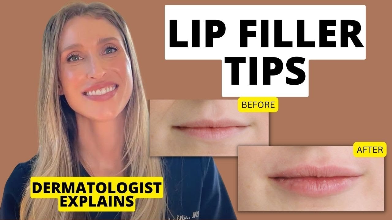 Dermatologist Shares 9 Lip Filler Tips to Know Before and After Treatment