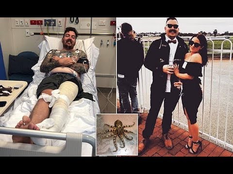 Fisherman miraculously survives bite from deadly blue-ringed octopus - Daily News