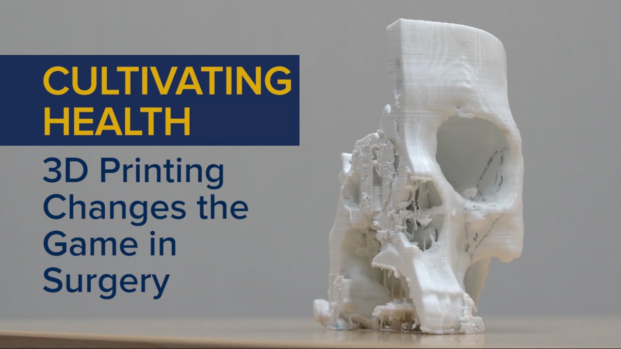 3D Printing Changes the Game in Surgery - Cultivating Health