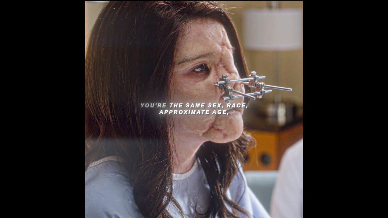 The mother donated her daughter's face to this girl who had suffered severe facial injuries.#edit