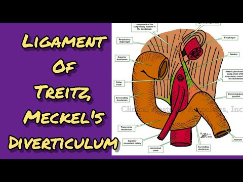 Ligament of Treitz , Meckel's diverticulum