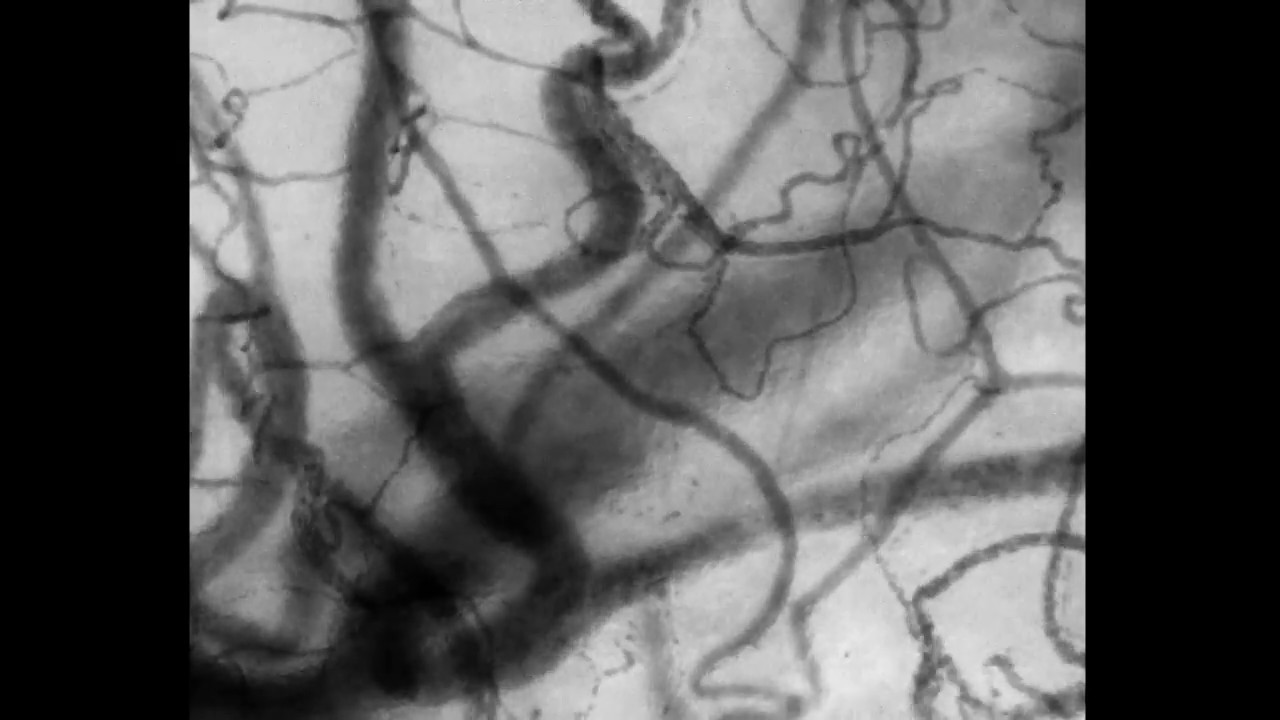 Preserved microcirculation