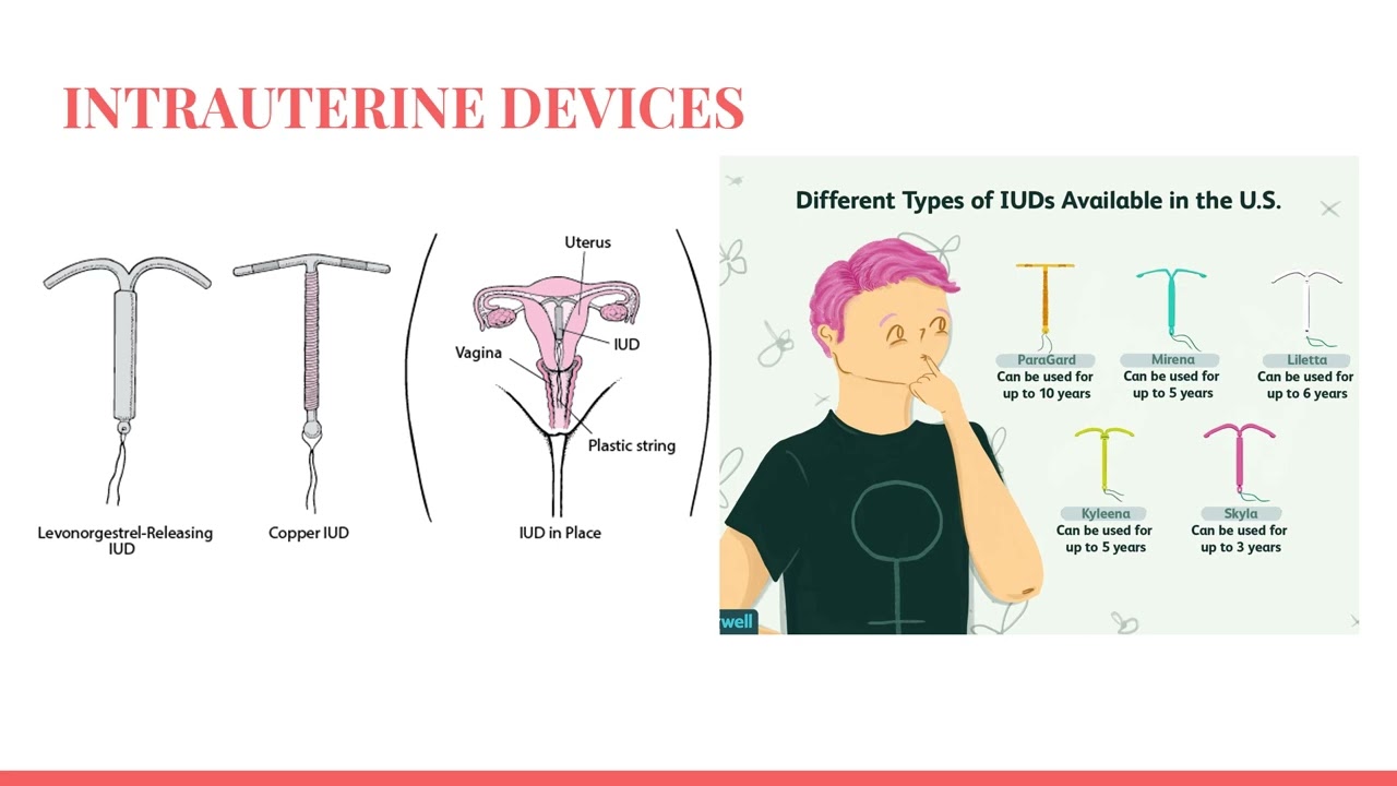 CONTRACEPTIVE METHODS PPT VIDEO