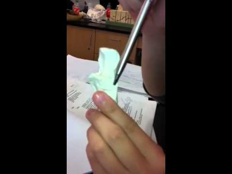 Ulnar bone model Tuberosity anatomy