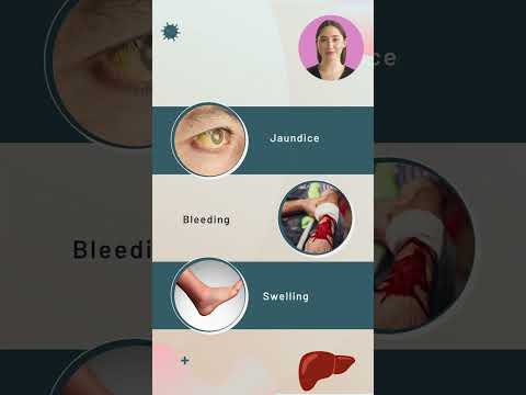 5 Warning Signs of Liver Cirrhosis You Should Know About for Better Liver Health