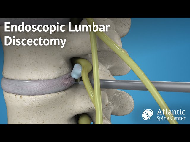Cutting Edge Spinal Healthcare | Atlantic Spine Center