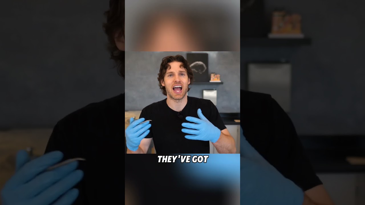 The Three Tonsils