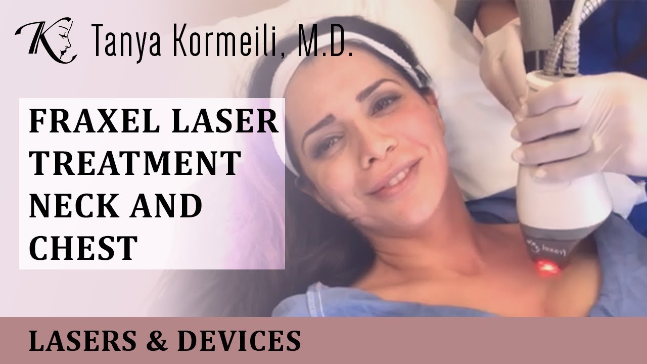 Fraxel Laser Therapy in Santa Monica & Beverly Hills