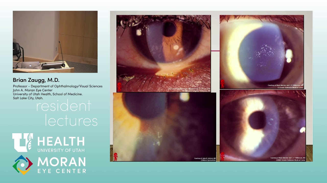 Corneal Dystrophies [ARCHIVE]