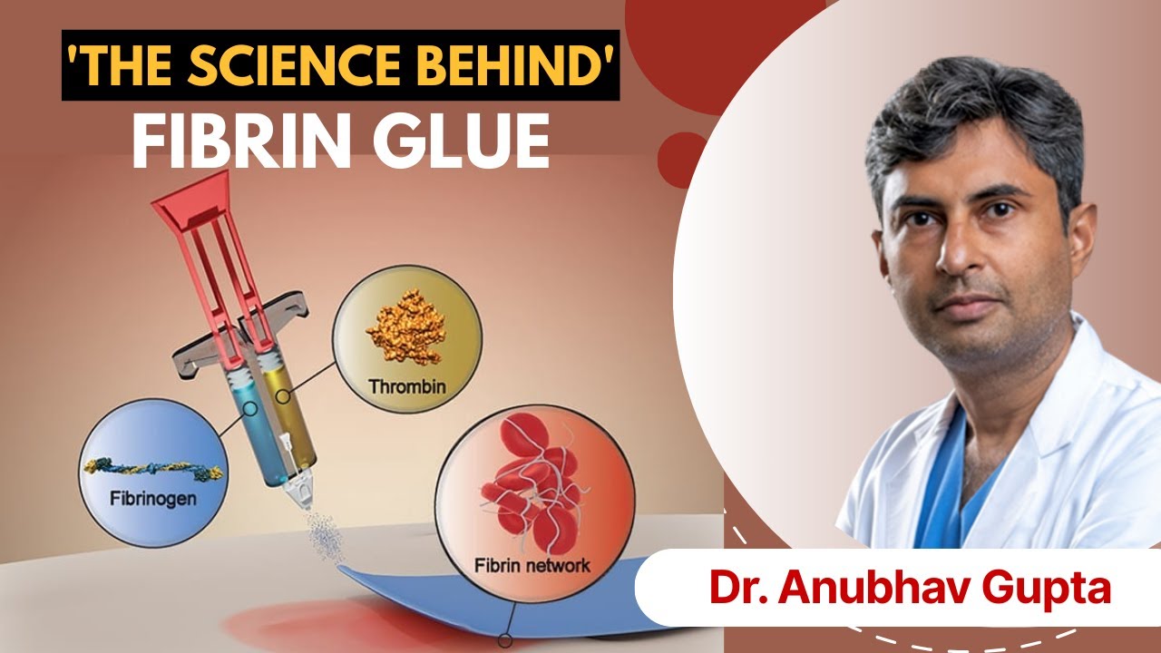 What exactly is Fibrin Glue and how does it work in modern medicine?