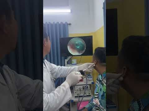 Your ENT Problem Solver by Dr ENT #entdoctor #otolaryngology