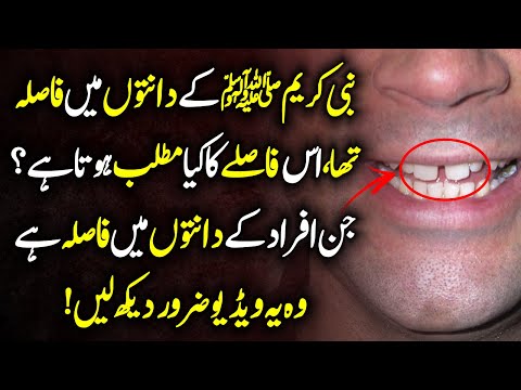 Meaning Of Gap Between Teeth Urdu Hindi - Prophet SAW K Dantoun Main Fasla Tha || Urdu Lab