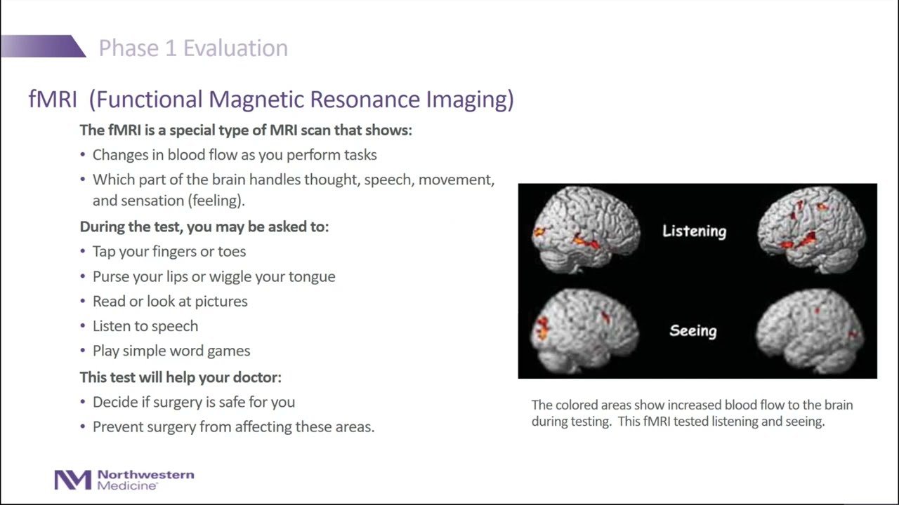 Can Epilepsy Surgery Help? - Phase 1 Evaluation