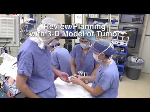 Minimally Invasive Approach to Pancoast Tumor Using 3D Printing - Mayo Clinic