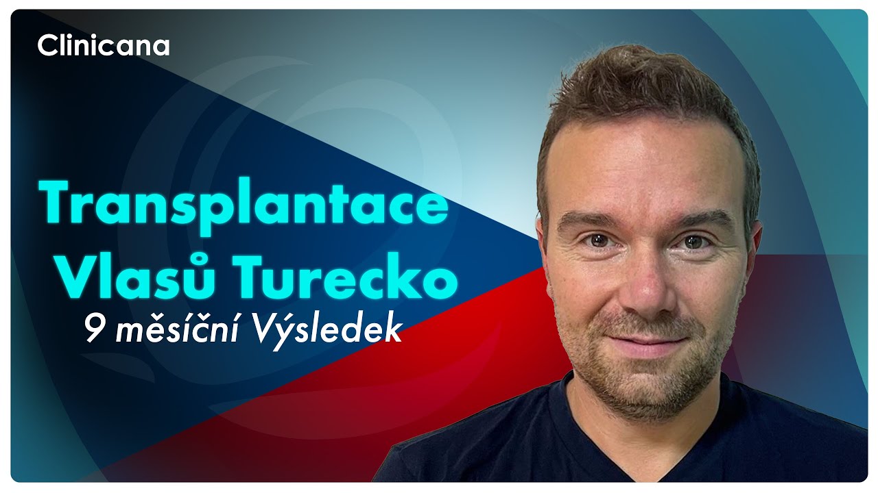Transplantace vlasů Turecko 2024 - Nejlepší klinika v Istanbulu