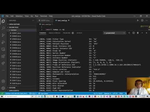 How to read DICOM files Lecture001 - code section