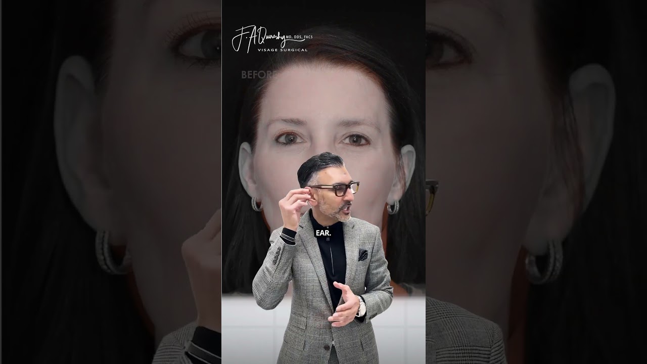 Dr. Qureshy Discusses Otoplasty: Insights on Ear Surgery