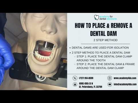 2-Step Method to Place a Dental Dam - Academy for Dental Assistants