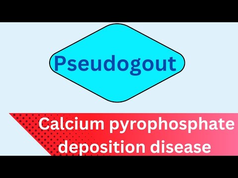 Pseudogout (Calcium Pyrophosphate Deposition Disease): Causes, Symptoms, and Treatment