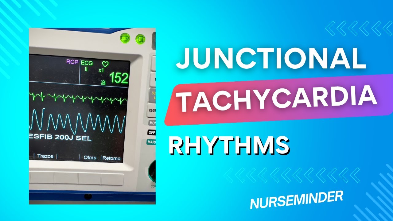 Junctional Tachycardia on ECG: The Inverted P Wave You Can’t Ignore!