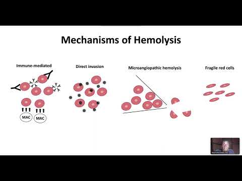 Hemolytic Anemia Overview