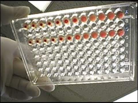 Pathogens Lesson 4: Laboratory Diagnosis