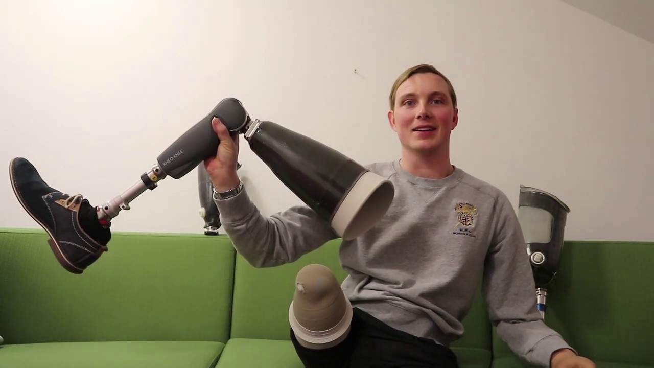 My review of different prosthetic sockets that I tried