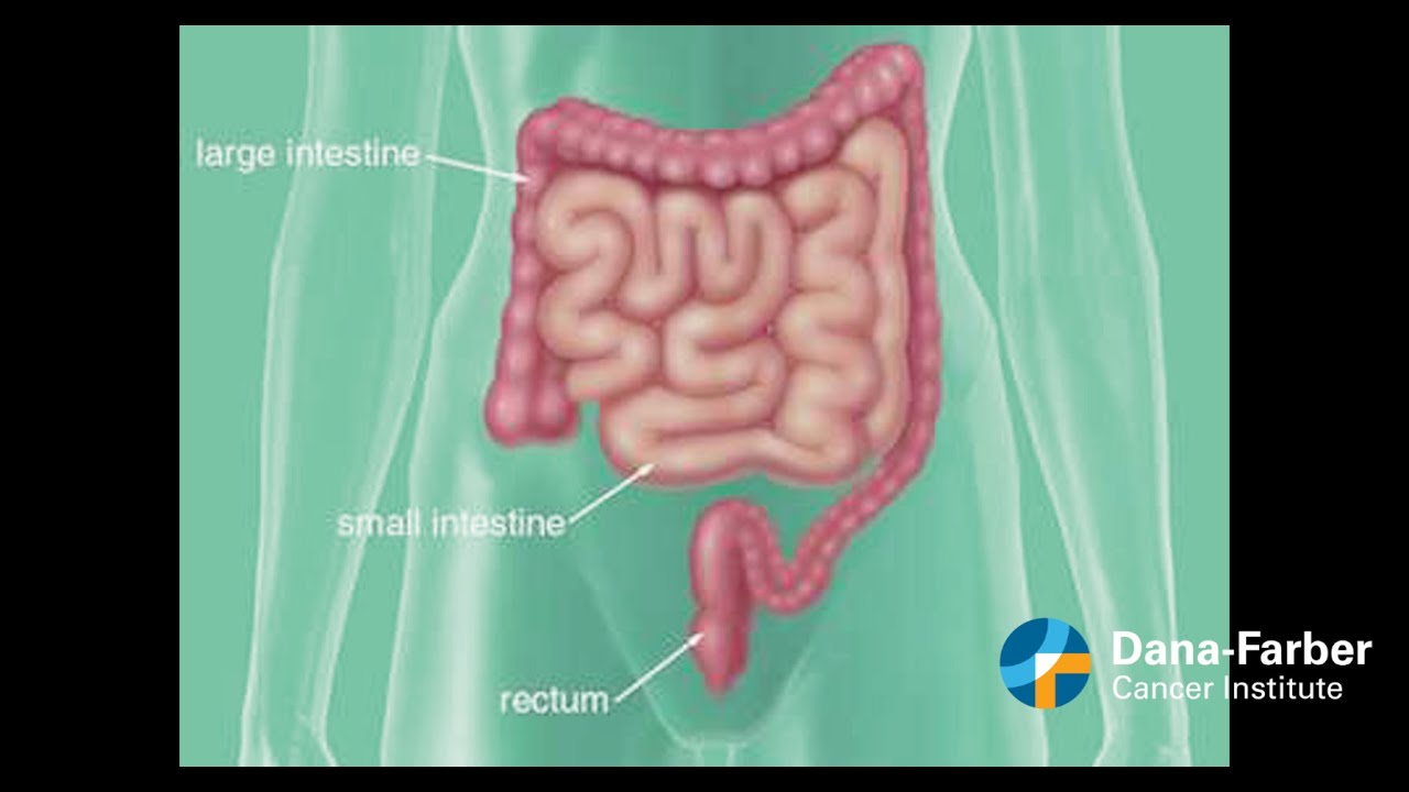 Colon v. Rectal Cancer: What you need to know