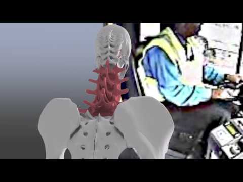 Clearly Show Spinal Injuries