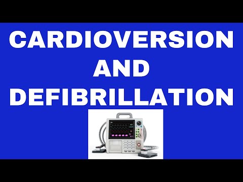 Cardioversion and Defibrillation | Implantable Cardioverter Defibrillator (ICD)