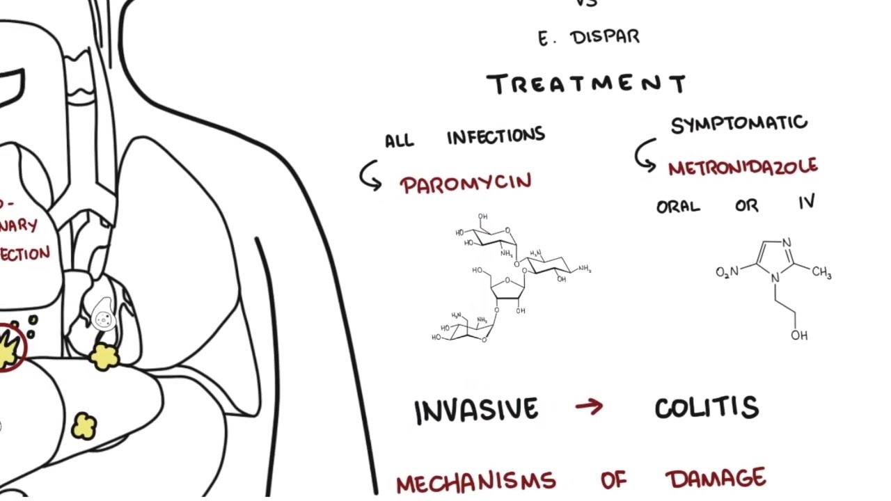 Amebiasis - entamoeba histolytica symptoms, pathophysiology, diagnosis, treatment