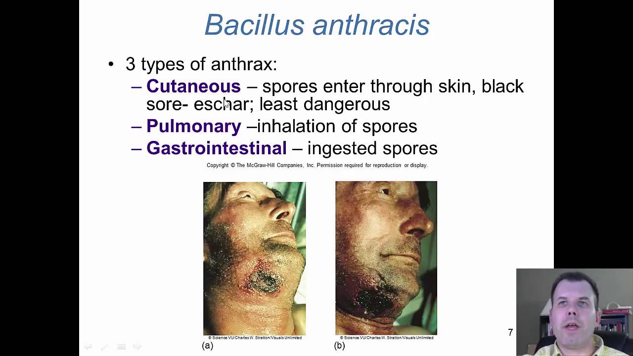 Chapter 19   Gram Positive Bacilli of Medical Importance