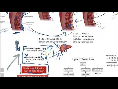 Coronary Artery Disease 4 Dyslipidemia