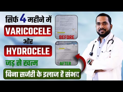 Bina surgery ke hydrocele thik hota hai ya nhi | Dr. Himanshu Bharat Homeopathy