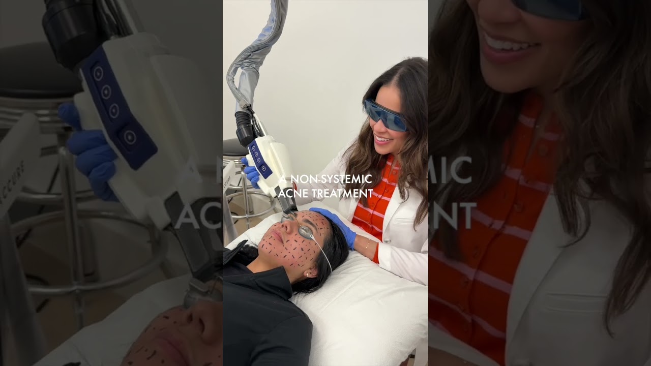 ACCURE Laser For Acne: Treatment Explained