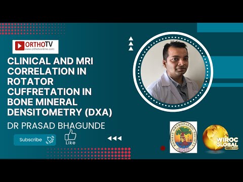 Clinical and MRI Correlation in Rotator Cuff - Dr Prasad Bhagunde