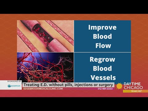 Treating E.D. without pills, injections or surgery