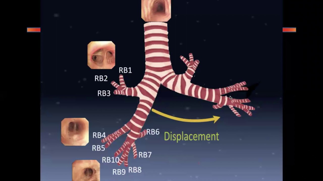 Anatomy of Bronchopulmonary Segment