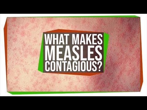 Why Is The Measles Virus So Contagious?