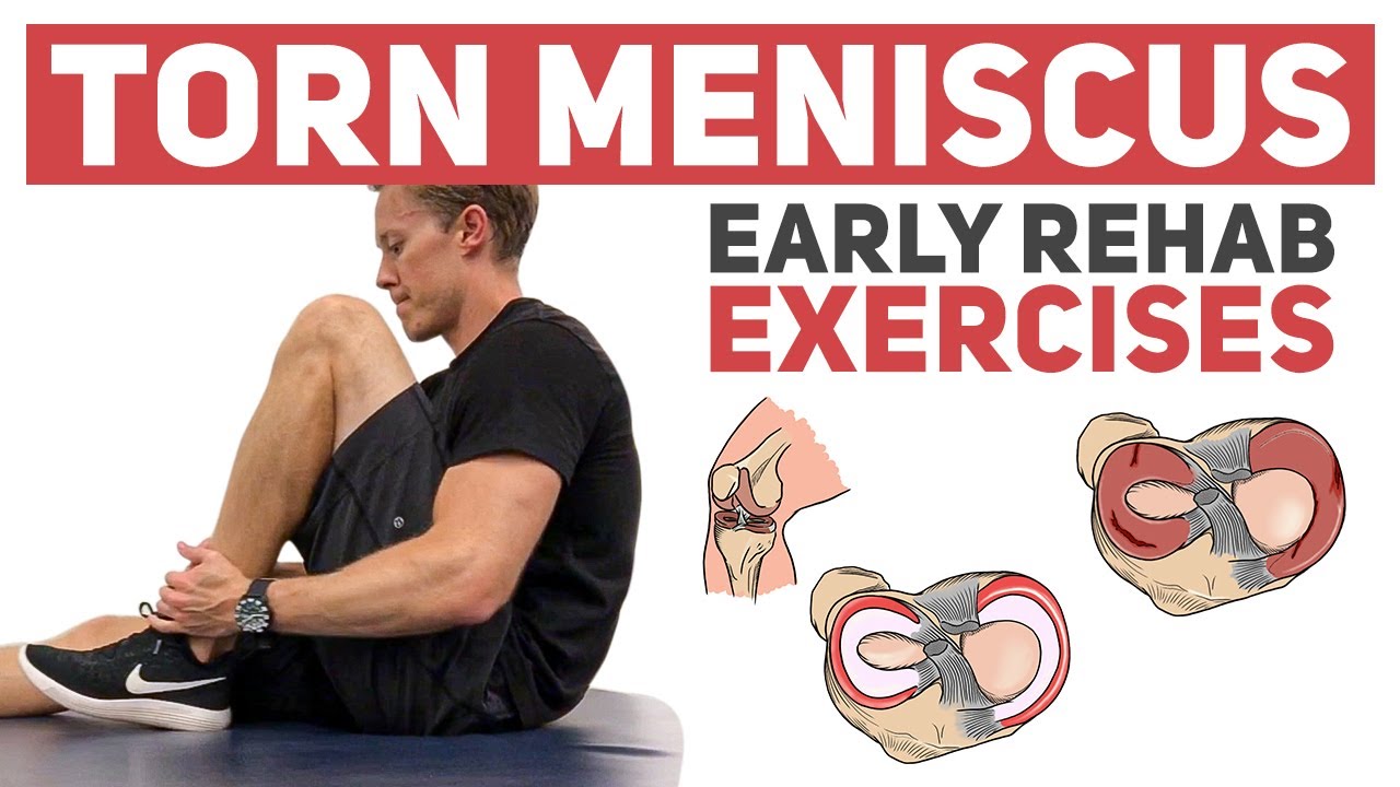 Meniscus Tear - Start With These Rehab Exercises