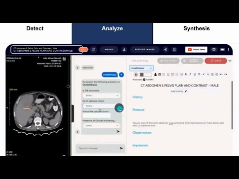 Revolutionizing Radiology Reporting with GenAI at 5C Network
