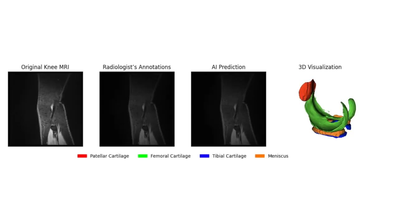Creating 3D Anatomical Models with AI-based Medical Imaging Data