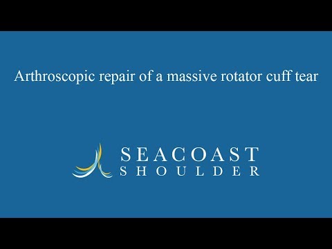 Arthroscopic repair of a massive rotator cuff tear