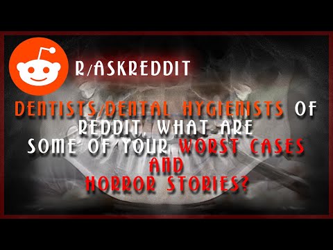 Dentists hygienists of Reddit, some of worst cases and horror stories? (r/AskReddit | The Reposter)
