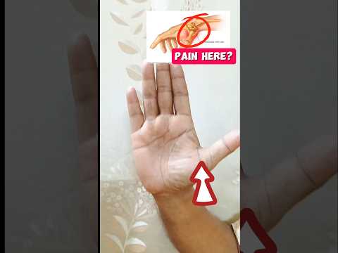 CMC Joint Pain Remedy!! Fast Relief