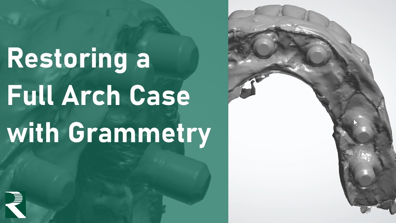 Restoring a Full Arch Case with Grammetry
