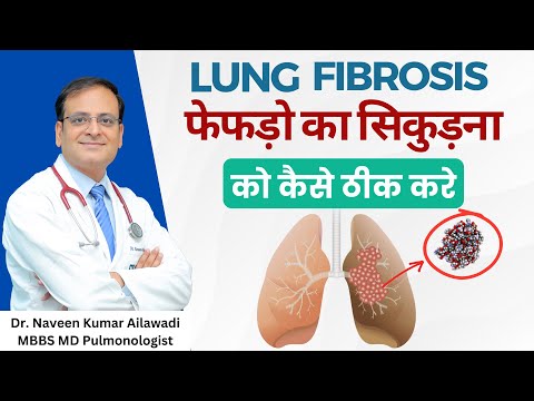 FeFdo Ka Sikudna | Lung Fibrosis को कैसे ठीक करे | Lung Fibrosis Treatment | Dr. Naveen Ailawadi