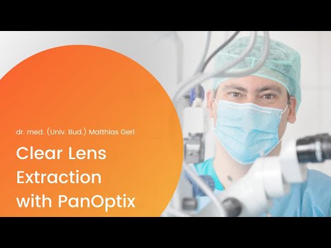 Clear Lens Extraction (CLE) with AcrySof IQ PanOptix lens implantation